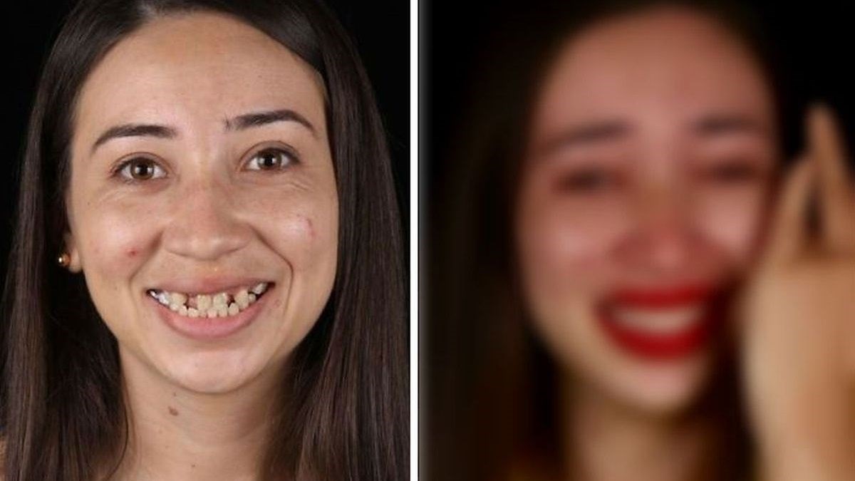 Transformacije koje izvodi ovaj zubar dokazuju koliko su važni zdravi ...