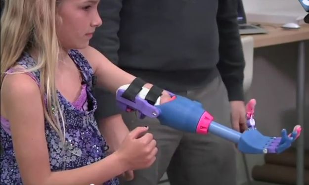 Djevojčica dobila robotičku ruku iz 3D printera: "Ovo će promijeniti ...