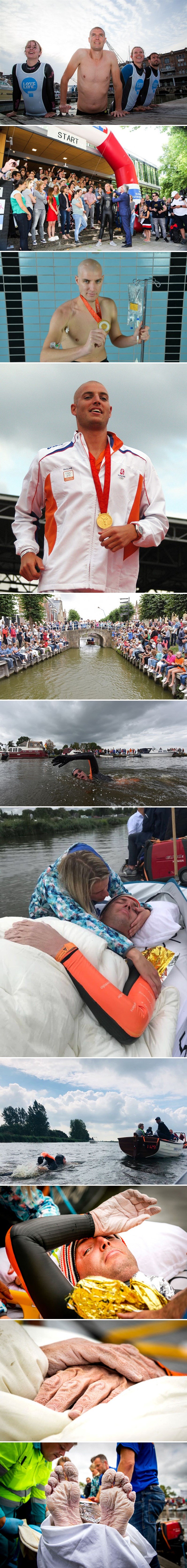 Pogledajte kako su izgledale ruke i noge plivača koji je pobijedio rak ...